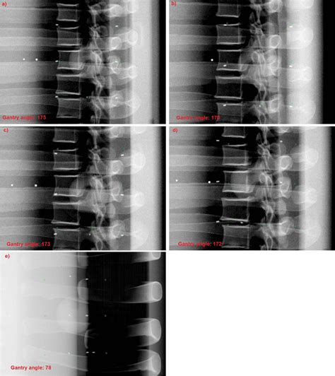 Figure 4 From Evaluation Of The Geometric Accuracy Of Surrogate Based