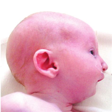 Typical Craniofacial Anomalies Download Scientific Diagram