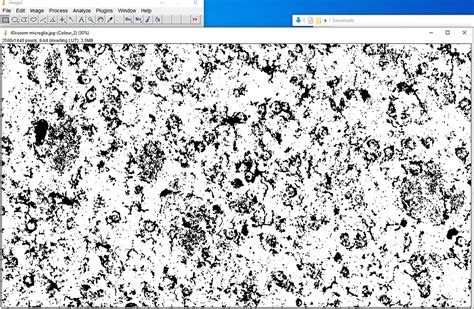 Issues With Image J Thresholding Image Analysis Image Sc Forum