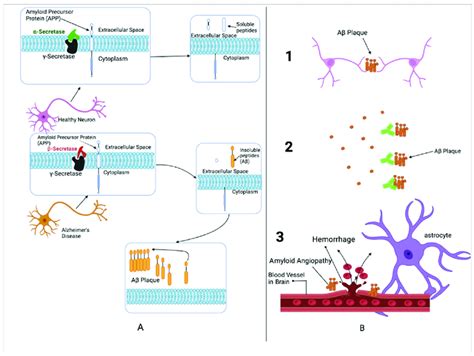 Amyloid Beta Pathogenesis A Normal Top And Degenerate Bottom Download Scientific Diagram
