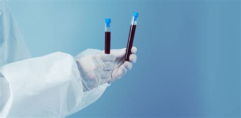 Colesterol Hdl Galenica