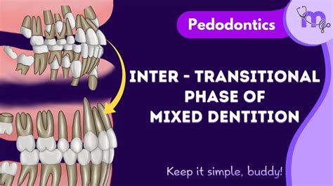 Inter Transitional Phase Of Mixed Dentition Pedodontics Animated Explanation Youtube