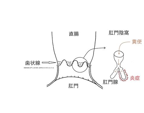 疾患について 東幸クリニック 内科・外科（新潟市中央区東幸町）