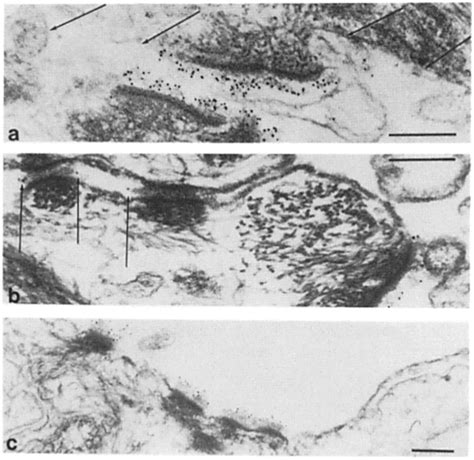 Immunolocalization By Cryosectioning A Or En Bloc Method B C Of