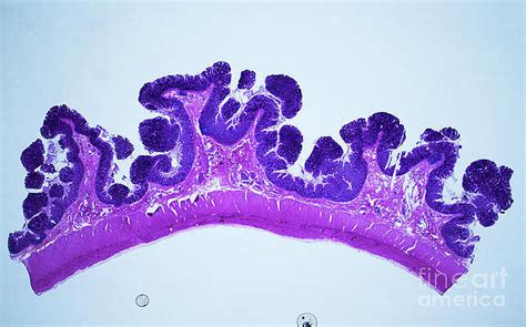 Polyp Art Pixels
