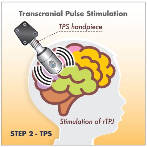 TPS治療步驟三步曲 Amazing Grace NeuroScience Limited