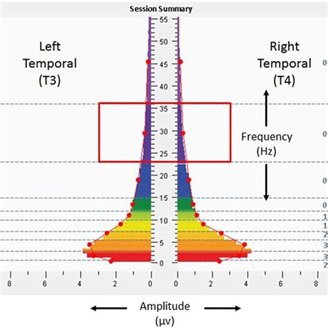 Fast Fourier Transform Spectral Display Of Brain Electrical Activity