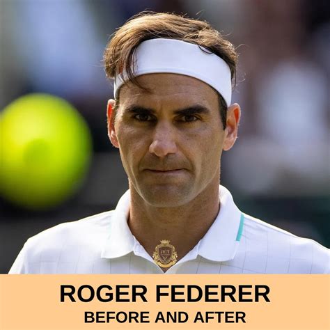 Roger Federer Hair Transplant Hair Center Of Turkey