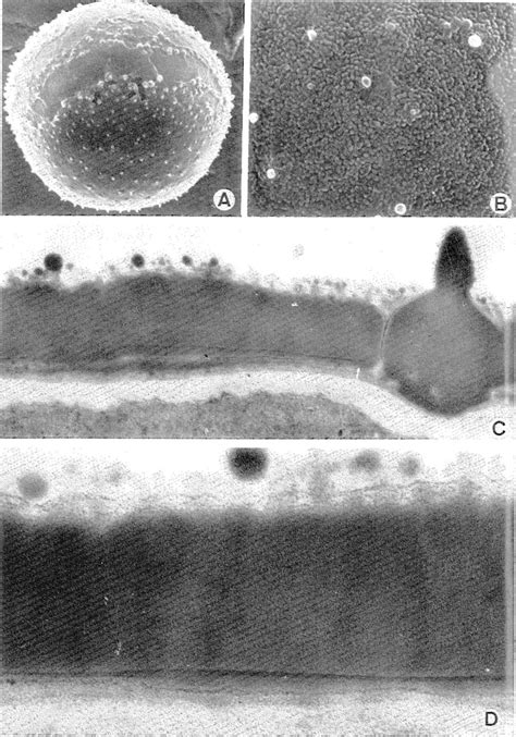 Pollen Grain And Exine Structure In Heloniopsis Orienmlis A Download Scientific Diagram