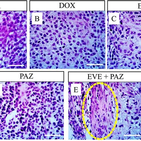 Efficacy Of Treatment Of The Osteosarcoma Pdox Mouse Model On Tumor Download Scientific Diagram