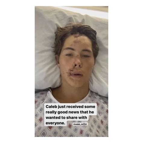 Tiktoker Sofreu Ferimentos Graves Ap S Cair De Penhasco Em Lava Quente No Hava Purebreak