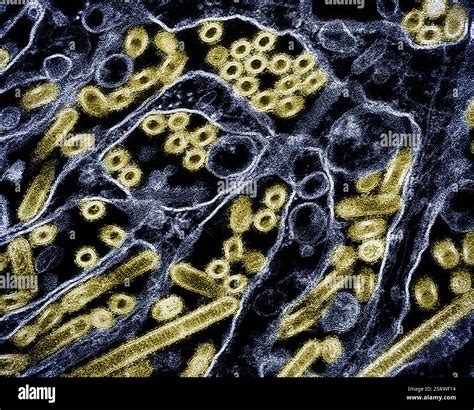 Avian Influenza A Virus H5n1bird Flu Colorized Transmission Electron