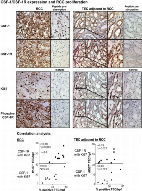 Csf 1 And Csf 1r Co Expression On Rcc Promotes Survival Proliferation Download Scientific
