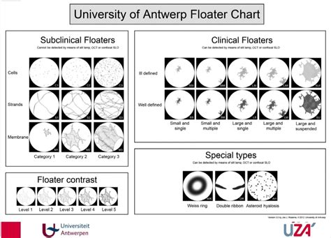 Eye Floaters Action Movement Guys This Is The Floaters I Am Suffering