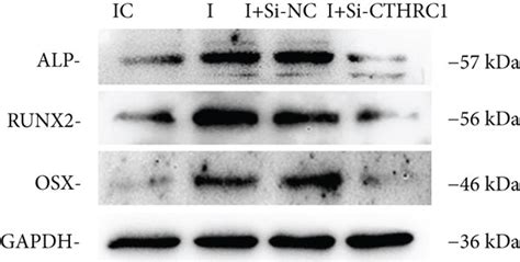 Cthrc1 Partially Reverses The Influence Of Hsa Let 7b On The Osteogenic