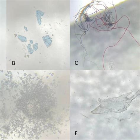 Percent Composition Of A Different Microplastic Polymer Type And B The Download Scientific