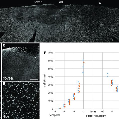 Vglut1 Expression In Aged Marmoset Retina A Vglut1 Staining In The Download Scientific