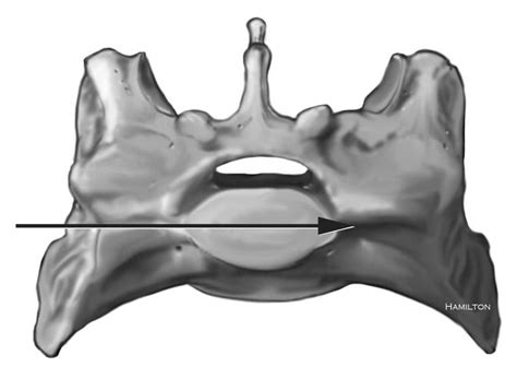 Sacroiliac Joint Pelvis And Hip Joint Ivis