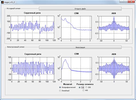 Разностное уравнение фильтра в общем виде