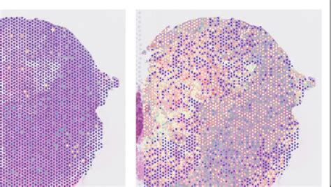My Phd Journey In Spatial Transcriptomics Safayat Mahmud Khan Posted