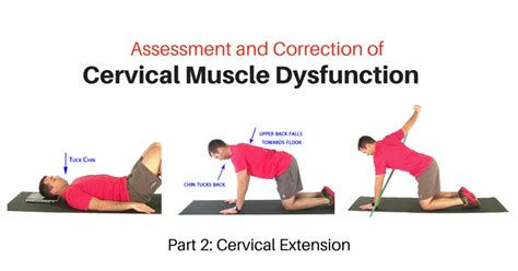 Neck Exercises Archives My Rehab Connection