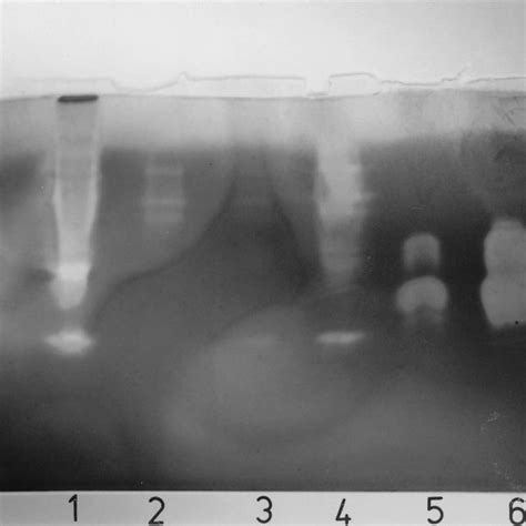 Xylanase Zymogram Of Crude Enzyme And Fractions Of Different Molecular