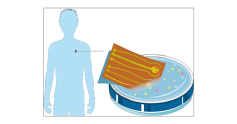 Recent Development Of Implantable Chemical Sensors Utilizing Flexible And Biodegradable