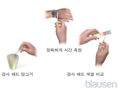 Image딥스틱 소변 검사 Msd 매뉴얼 일반인용