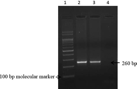 Standardization Of Nested Pcr Assay For Mitochondrial Large Subunit