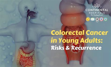 Colorectal Cancer In Young Adults Risks And Recurrence