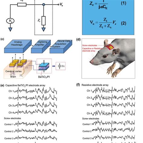 9 Spatial Electrode Arrangement Shown Through Mri Image Kutsy 1999