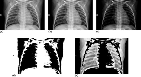 Image Examples Of The Different Steps In The Pre Processing Pipeline