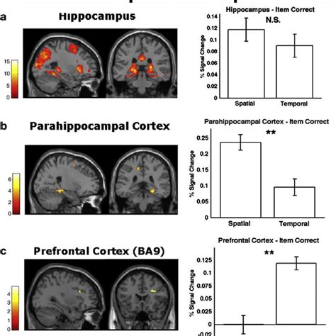 brain regions active during spatial and temporal retrieval responses
