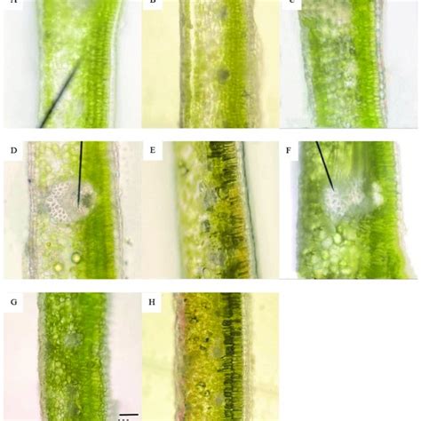 Schematic Diagram Of Leaf Anatomical Structure A September 2020 E
