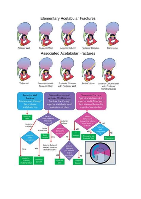 Important Radiological Classification Of Fracture And Avn Pdf