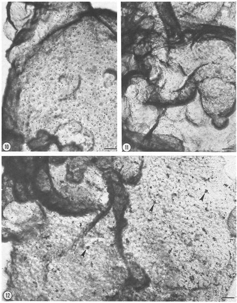Fig 10 Surface Replica Of A Washed Platelet Stimulated With Ade