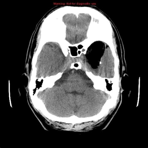 Pin On Rontginologyradiology