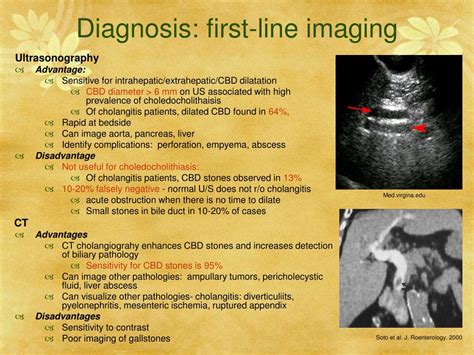 Ppt Cholangitis And Management Of Choledocholithiasis Powerpoint Presentation Id 4488108