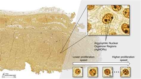 Deep Learning Based Automatic Assessment Of Agnor Scores Measuring Proliferation Speed [bvm