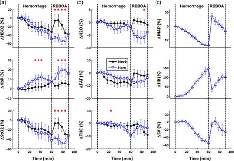 Diffuse Optical Spectroscopy Dos And Cardiac Parameters From A
