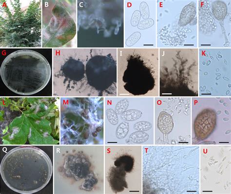 Figure 3 From First Report Of Ampelomyces Quisqualis From Sycamore And