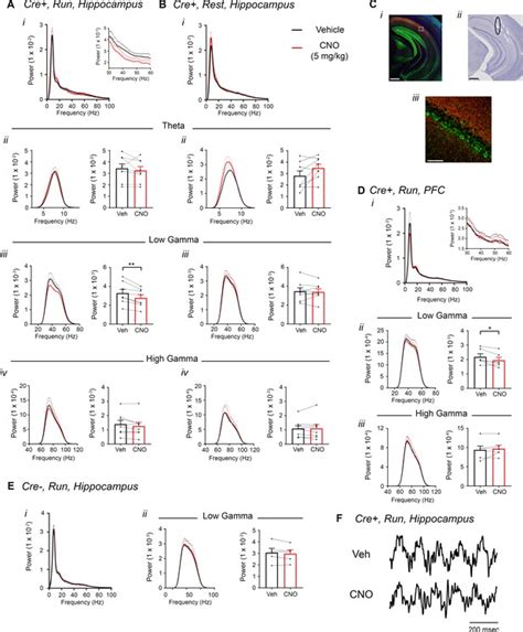 Figures And Data In Ca2 Neuronal Activity Controls Hippocampal Low Gamma And Ripple Oscillations
