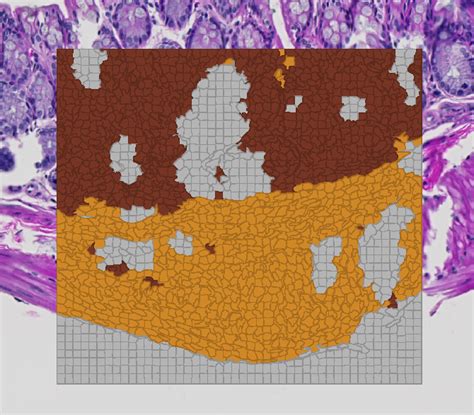 qupath guide creating classified annotation areas using slics image analysis image sc forum