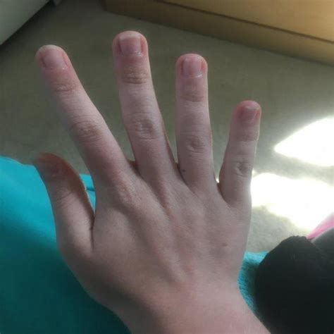 Measure Liquid Density Object Detection Dataset By Yolov8detectelec