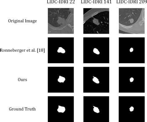 comparison of our method with 2d u net results download scientific