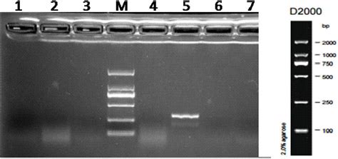 Clostridium Ghonii Specific Pcr Detection Primers And Method Eureka Patsnap