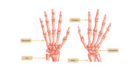 Radius Fracture