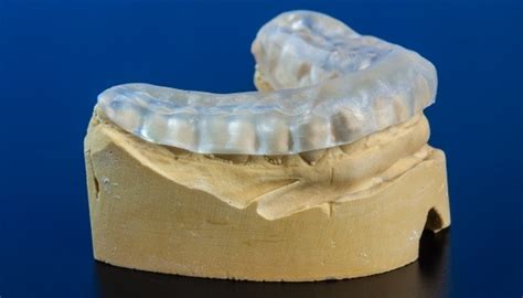 Nightguards For Bruxism West Caldwell Nj Teeth Grinding Magid