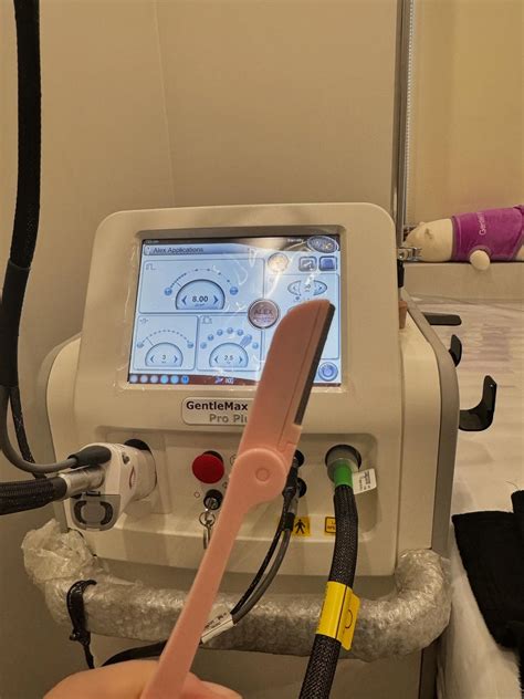 화장 잘 먹는 가성비 꿀 조합 ️얼굴전체제모 라라필 제네시스 토닝 ️ 메인은 얼굴 솜털 제모 여자들 은근 솜털이 많은데 솜털은 얇아서