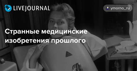 Странные медицинские изобретения прошлого Picturehistory — Livejournal